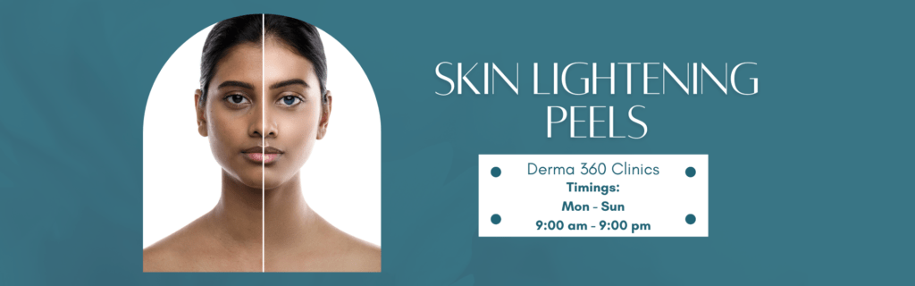 Skin Lightening Peels - Derma 360