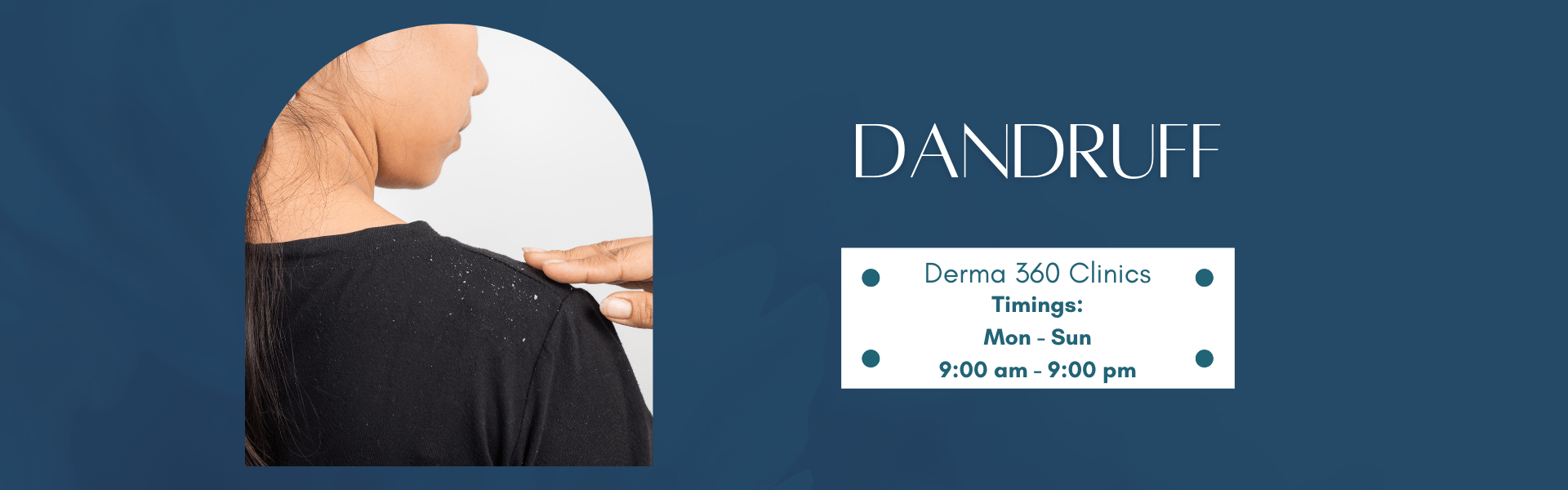 Dandruff - Derma 360